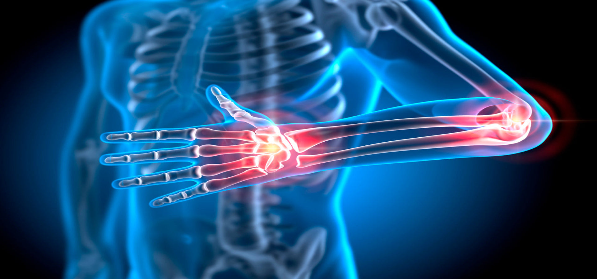 Preventing Tennis Elbow in Pickleball: Why Your Grip Might Be the Prob ...